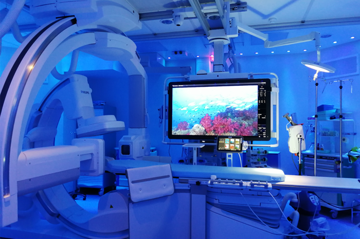 Treatment of aneurysms and strokes (CVA): Rennes University Hospital ...